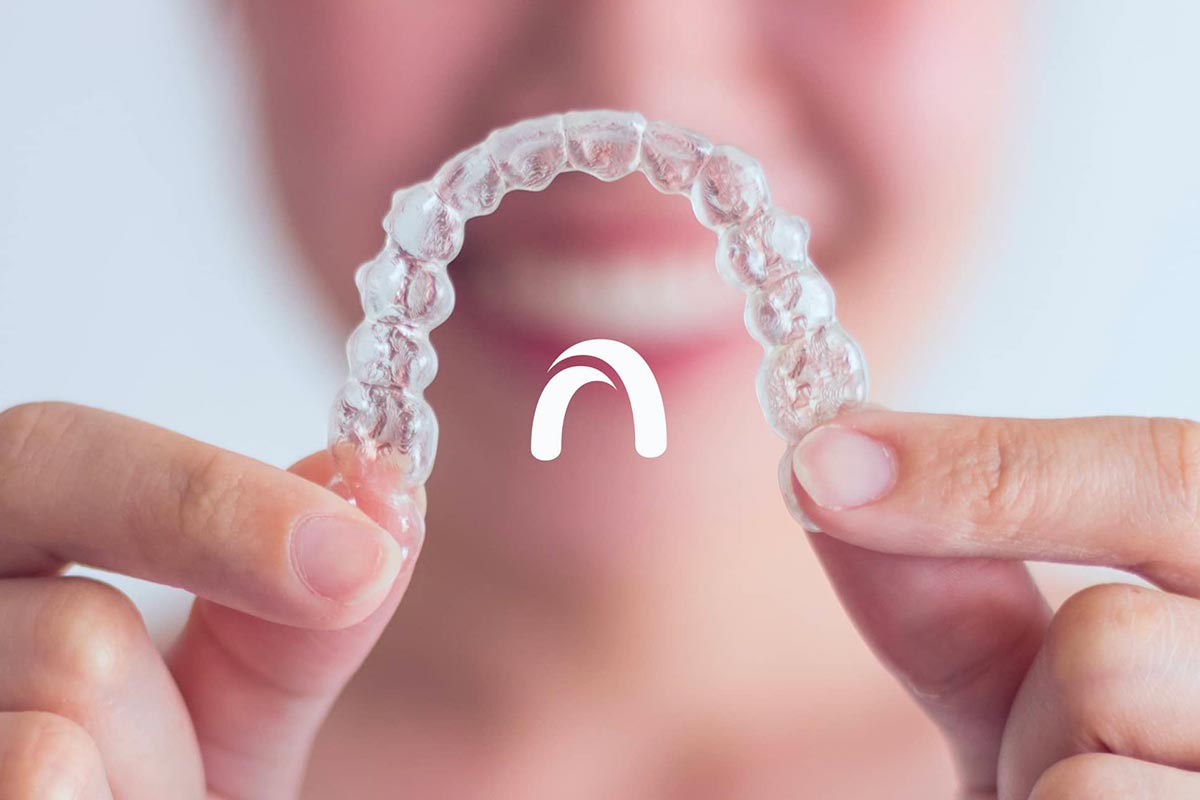 Meilleurs aligneurs dentaires : Comparatif, prix et avis